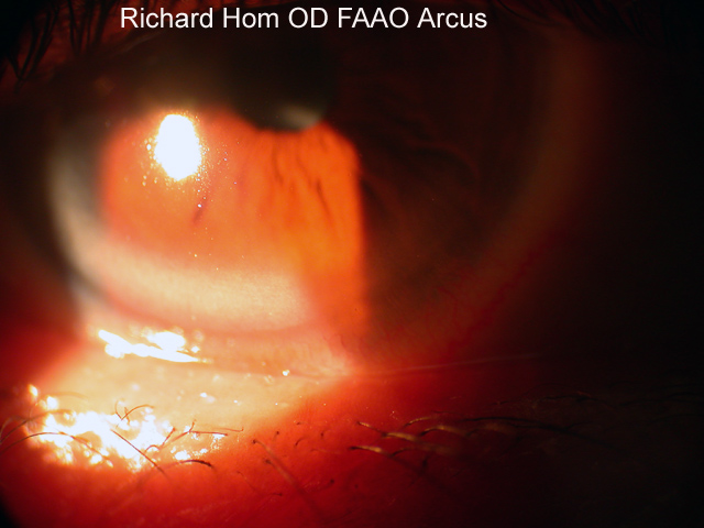 Photo Atlas, Page 1 - Richard Hom OD FAAO