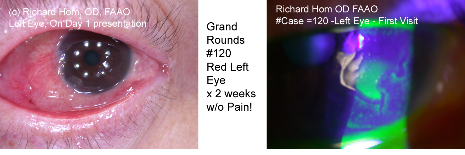 Grand Rounds Web Site Home Page - Richard Hom OD