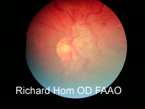 Photo Atlas, Page 1 - Richard Hom OD FAAO