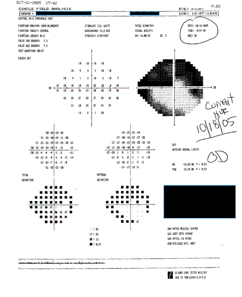 Grand Rounds Case 62 - Response - Richard Hom OD FAAO