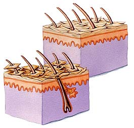 Life Cycle of the Scalpworm