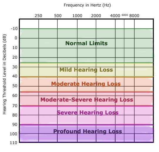 How To Read An Audiogram The Basics How To Read An Audiogram The Basics