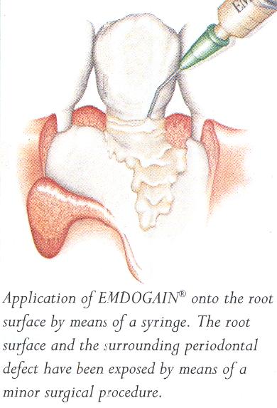 CONSODONINTEprofesionales002