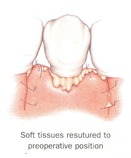 CONSODONINTEprofesionales002