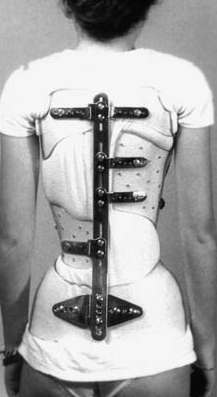 Corsets and health